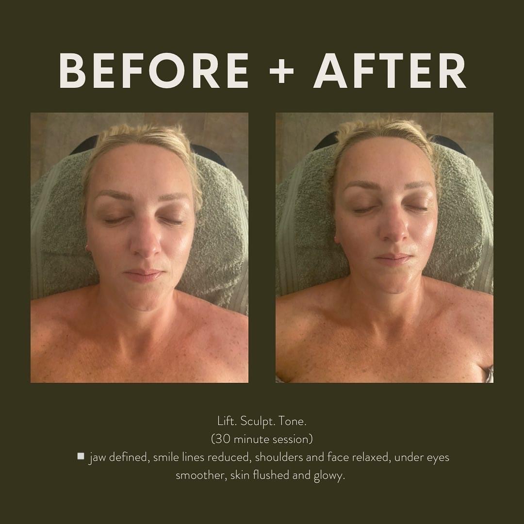 FaceZone – Stables Therapy Centre